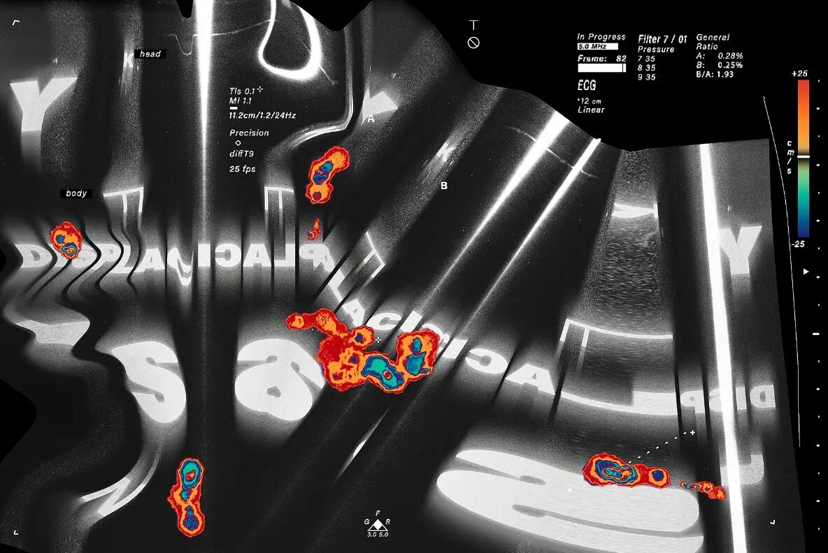 Echo Scan Distortion Effect - YouWorkForThem